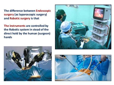 Tele And Robotic Surgery