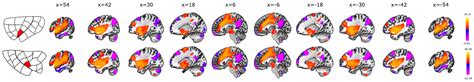 Brain Sciences Free Full Text Resting State Functional Connectivity Profile Of Insular