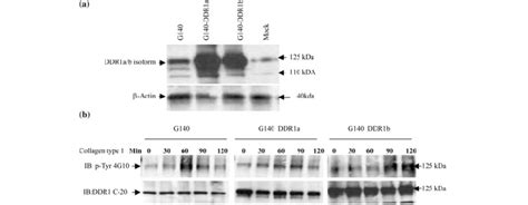expression and phosphorylation of ddr1a ddr1b in g140 glioma cell download scientific diagram