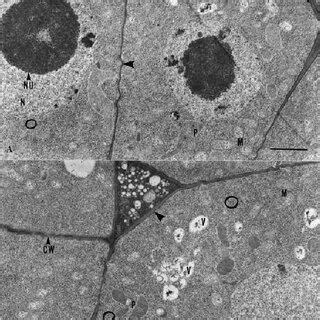 Cortical Cells From Control Root Tips A The Cell Corners Lack Download Scientific Diagram