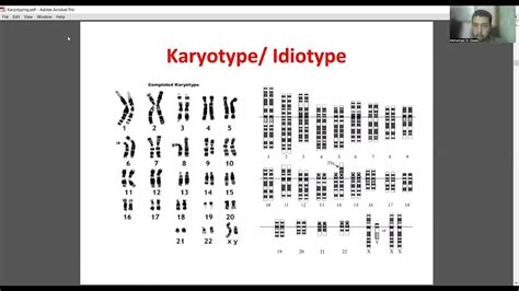 Lecture 9 Karyotyping Basics And Beyond By Dr Ahmed Elmarghany And Dr Mohamed El Deeb Youtube