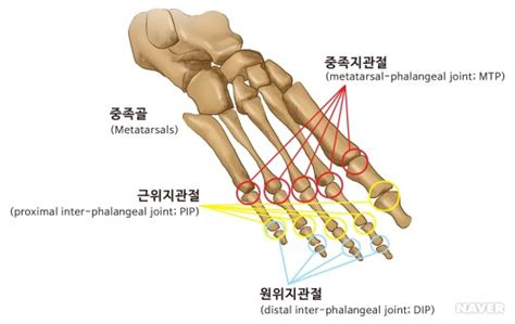 중동한의원 발가락 변형 네이버 블로그