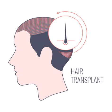 Receding Hairline Women Illustrations Royalty Free Vector Graphics