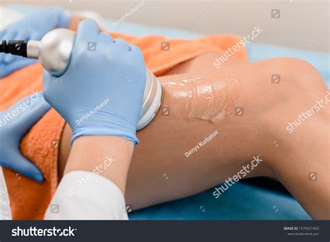Closeup Woman Getting Laser Epilation Procedure Stock Photo Shutterstock