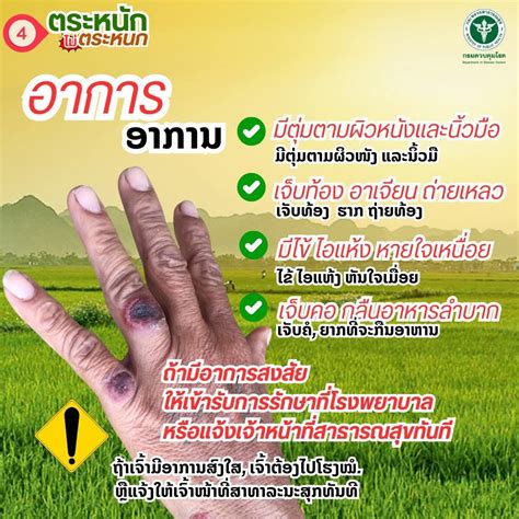 โรคแอนแทรกซ์ Anthrax กรมควบคุมโรค กระทรวงสาธารณสุข Facebook