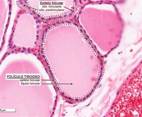 ¡tiroides Bajo Microscopio🔬 Los Lóbulos Contienen Folículos Tiorideos Formados Por Células