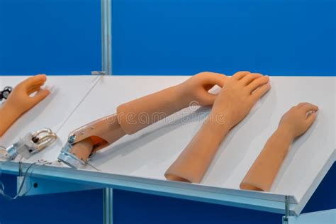 Silicone Arm Prosthesis In Showcase At Medical Exhibition Stock Image Image Of Aesthetic Body