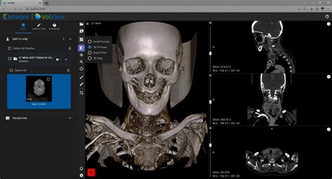 Screenshot Gallery VolView