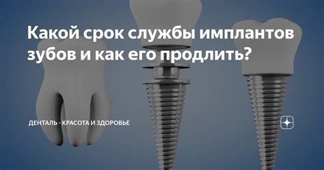 Какой срок службы имплантов зубов и как его продлить Цифровая стоматология Денталь в Москве