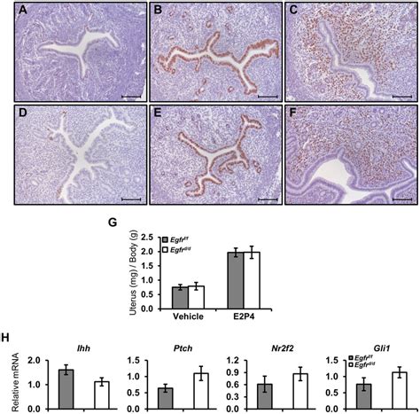 Ablation Of Egfr Does Not Alter Delayed Pregnancy Proliferation Or Download Scientific Diagram