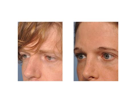 Makeup For Prominent Brow Bone Mugeek Vidalondon