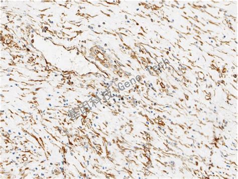 Tubulin β 鼠抗人 微管蛋白β（tubulin β）抗体试剂（免疫组织化学法）