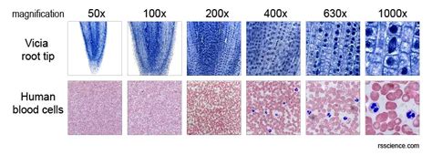 What Is A Microscope Function And Magnification Rs Science