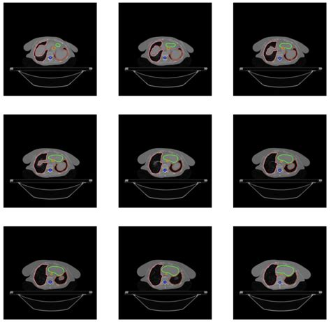 Dicom Rt Struct转换为niigzrtstruct Csdn博客