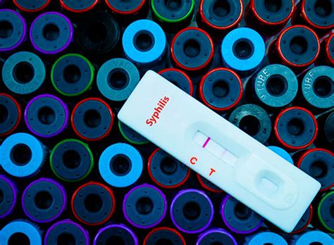 Health Unit Recommends Routine Testing For Syphilis Hometown News
