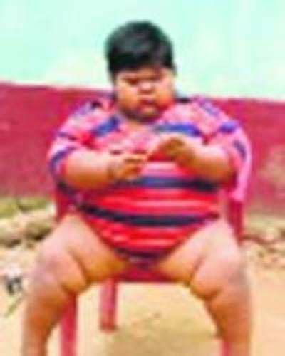 She Is 5 But Weighs 75 Kg