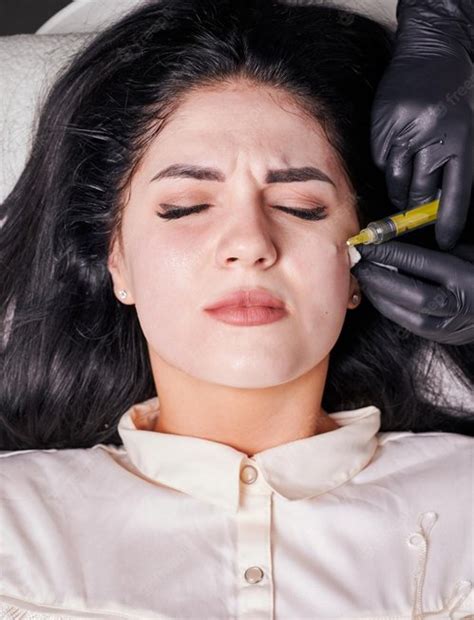 Micro Needling