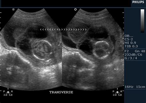 A Gallery Of High Resolution Ultrasound Color Doppler And 3d Images