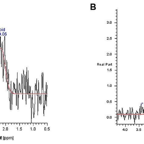 Examples Of Interpretable Mr Spectrum A And Non Interpretable Mr