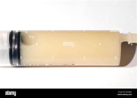 Fluid Removed From Swollen Knee Syringe Containing Fluid Removed From