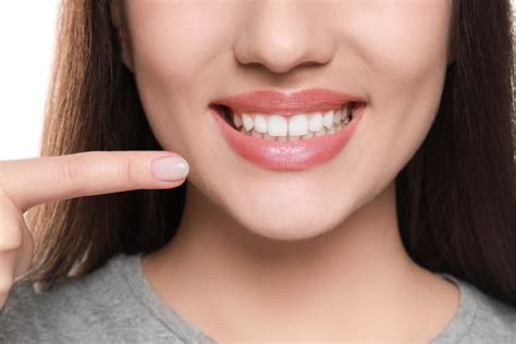 Overbite Teeth Navigating Treatment Options For A Brighter Smile