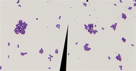 A Gram Stain Of S Epidermidis For Your Wednesday Viewing Pleasure R