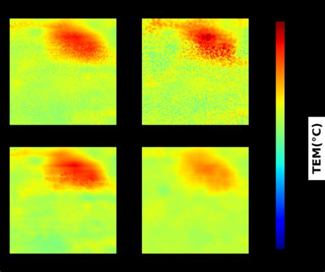 The Spatial Bias Distribution Between Hrcldas And Each Model In The