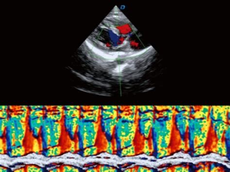 High End Cart Based Color Doppler Ultrasound System From China Manufacturer Dawei Medical