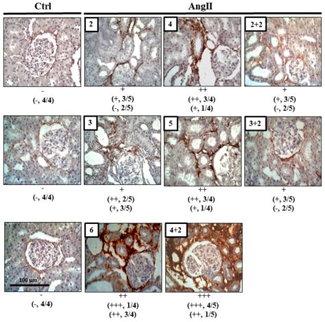 IJMS Free Full Text Role Of A RhoA ROCK Dependent Pathway On Renal