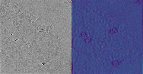 Ribosomes On Er Microsomes Pytom Match Pick