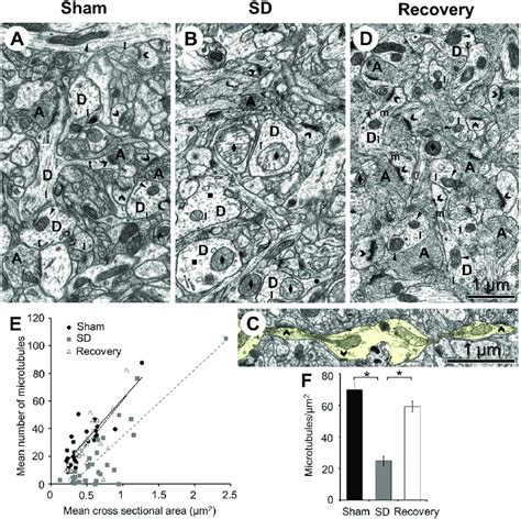 representative electron micrographs from neuropil in the hindlimb