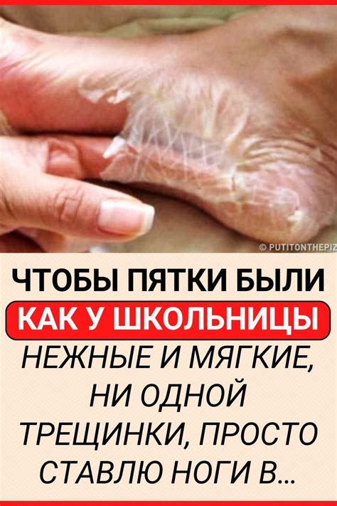 Косточка больше не болит! Потратила мелкие деньги на 2 средства, эффект ...