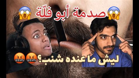 طبيب يجاوب ليش أبو فلّة ما عنده شنب ، وردة فعل أبو فلّة انصدم Youtube