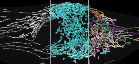 Image Processing Analysis With Imagej Fiji Ooa Oncology Graduate