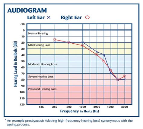 How To Read A Hearing Test Graph Understanding Your Hearing Test