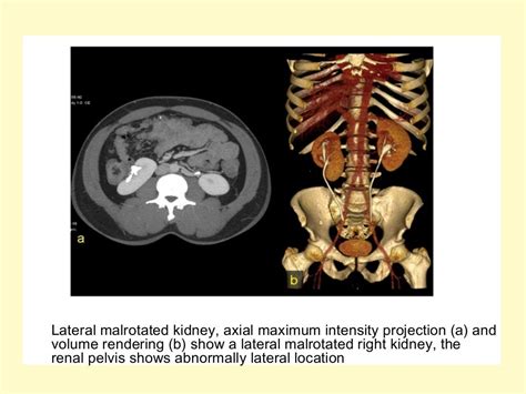 Congenital Anomalies Radiology