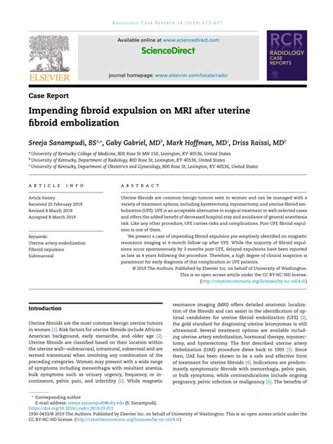 Pdf Impending Fibroid Expulsion On Mri After Uterine Fibroid Embolization