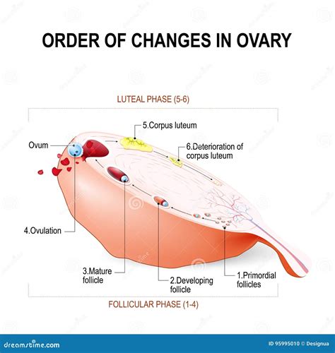 Corpus Luteum Cyst On The Ovary Functional Cyst Ovary Vector