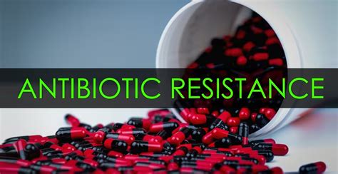 Unraveling Antibiotic Resistance Causes Prevention And Expert