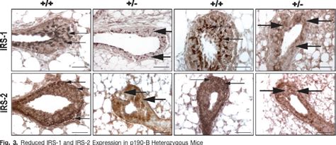 Figure 1 From P190 B Rhogap Regulates Mammary Ductal Morphogenesis