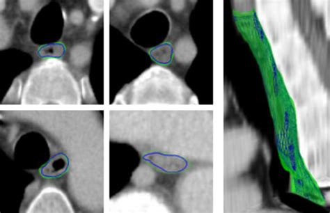 Left The Mean Segmentation Error For Different Distance Thresholds