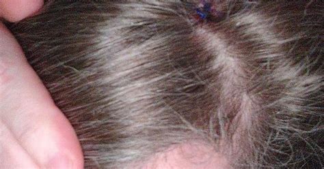 Scalp Album On Imgur