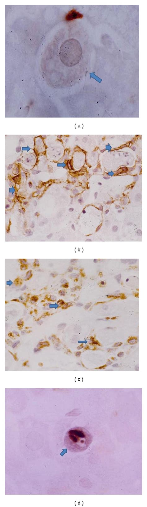 Apoptotic Assay Was Performed By Using TUNEL Assay H E X Brown