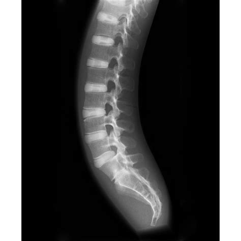 Model Lidské Páteře Pro Rtg Vyšetření Anatomické Pomůcky Cz
