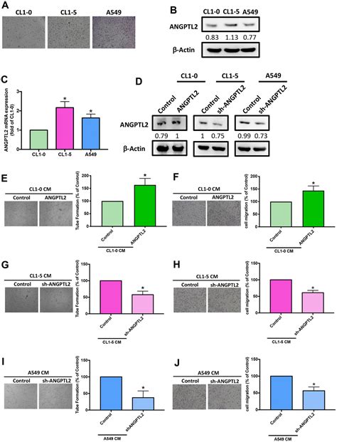 Angptl2 Promotes Vegf A Synthesis In Human Lung Cancer And Facilitates
