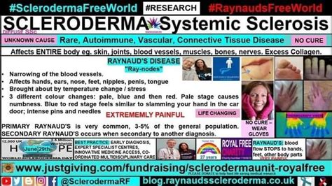 Raynauds Raynauds Scleroderma Awareness Global Patients