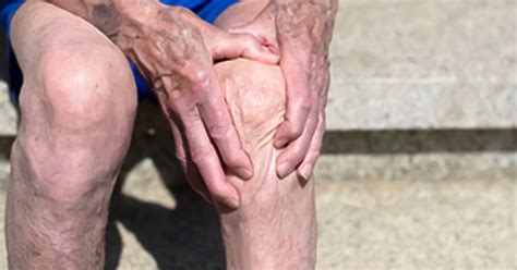 Chronic Venous Ulcer Goodman Med Research