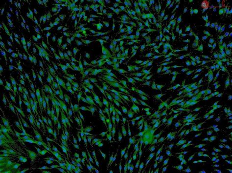 Human Adipose Derived Mesenchymal Stem Cells
