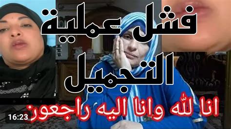 مغتربه فرنساإنا لله وانا الية راجعون وصيتكم بناتي فشل عملية التجميل