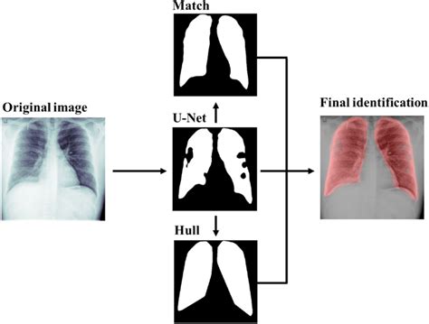 Lung Segmentation Of A 21 Year Old Male With Adequate Saturation Level Download Scientific